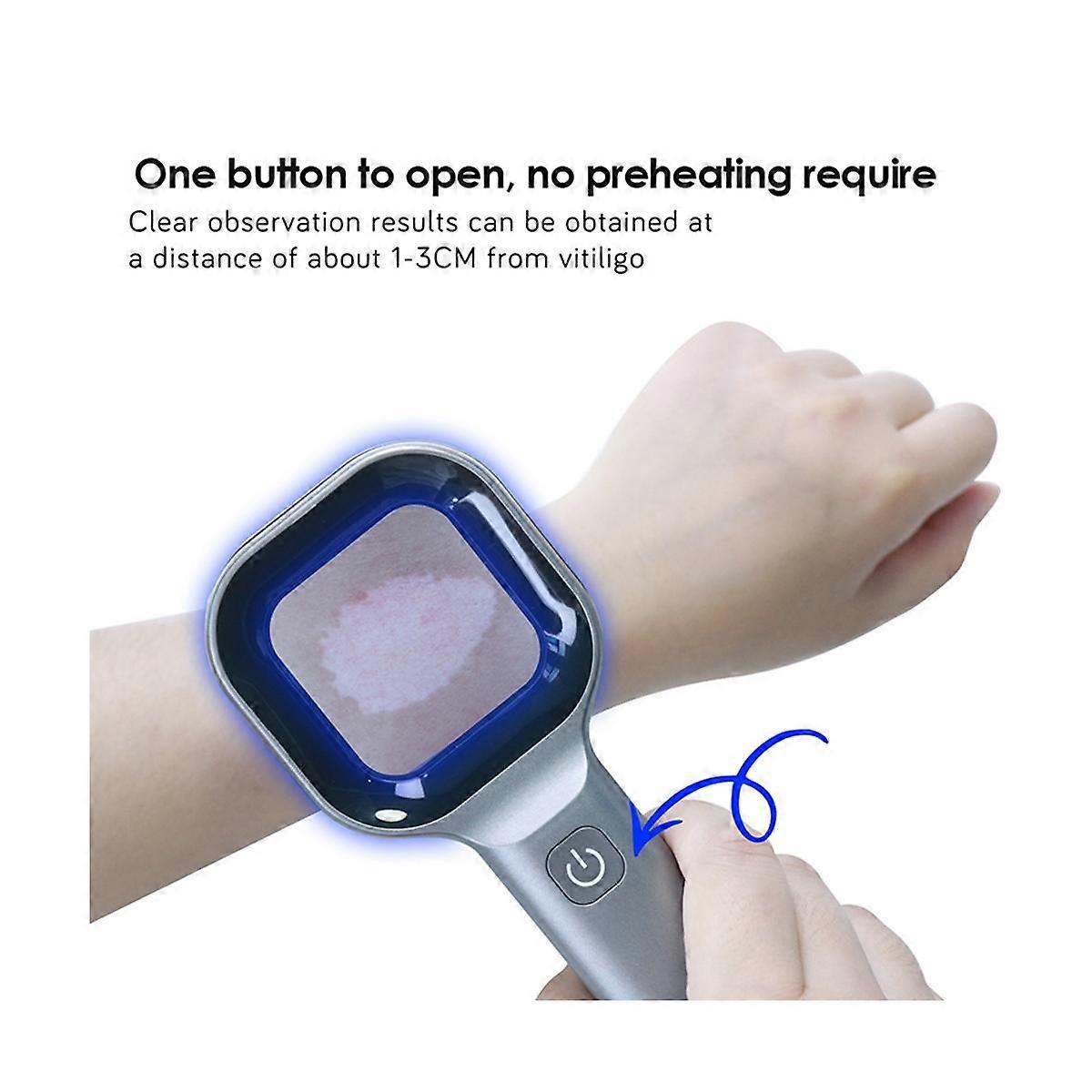 Woods Lamp Skin Analyzer Portable Facial Salon Beauty Analyzer UV Lamp ...