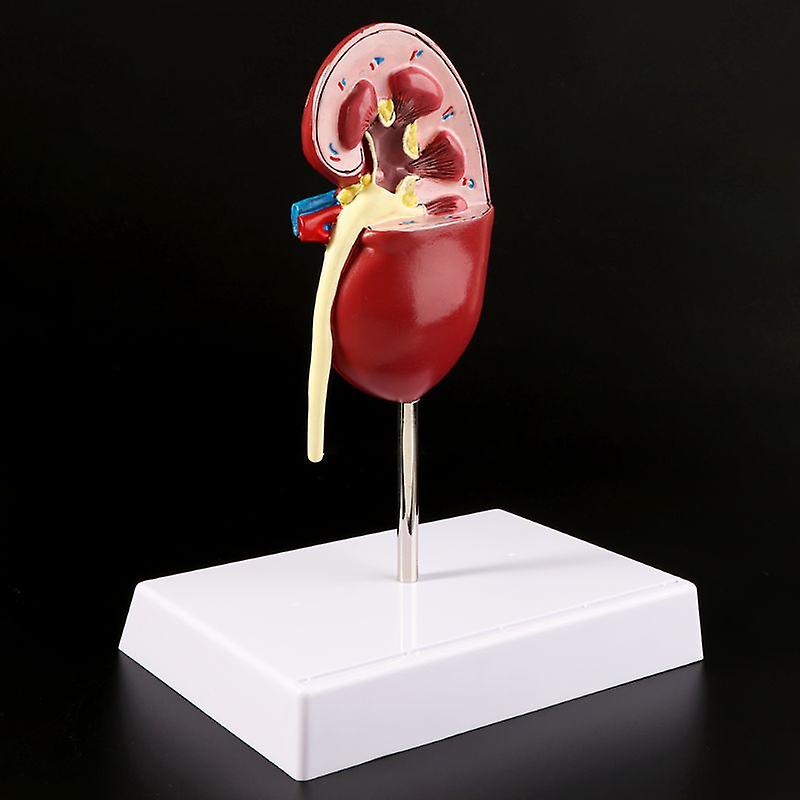 Medical props model life size human kidney diseased model anatomical ...
