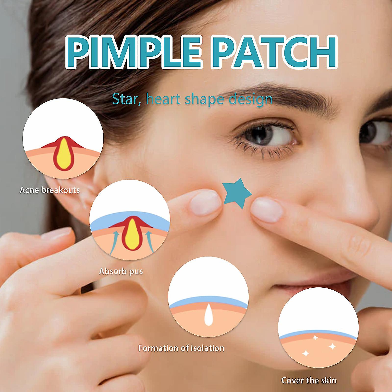 216pcs Pimple Patches, Invisible Natural Hydrocolloid Skin Tag Cover ...