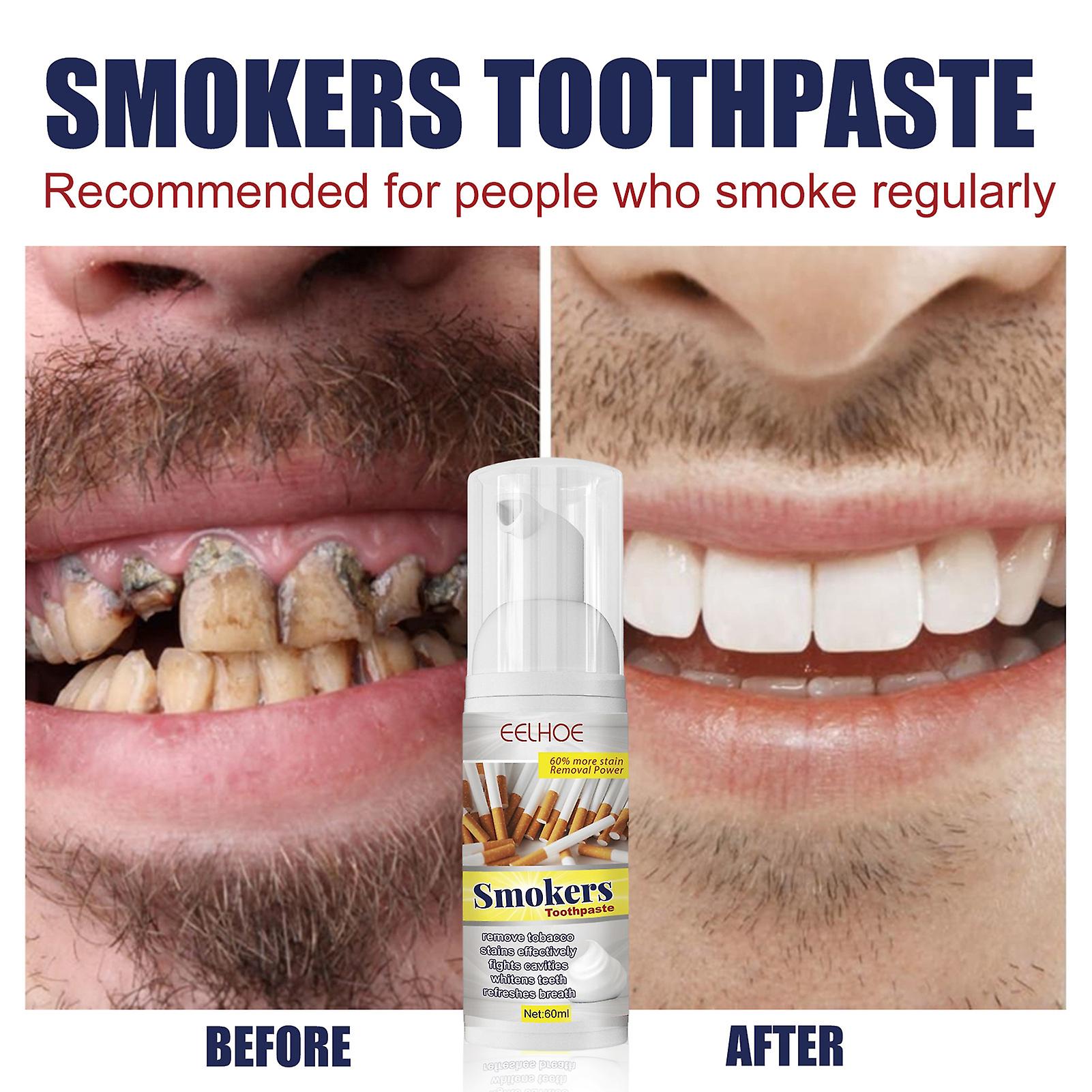 60ml Whitening Toothpaste Gentle Obvious Effect Safety Ingredient ...