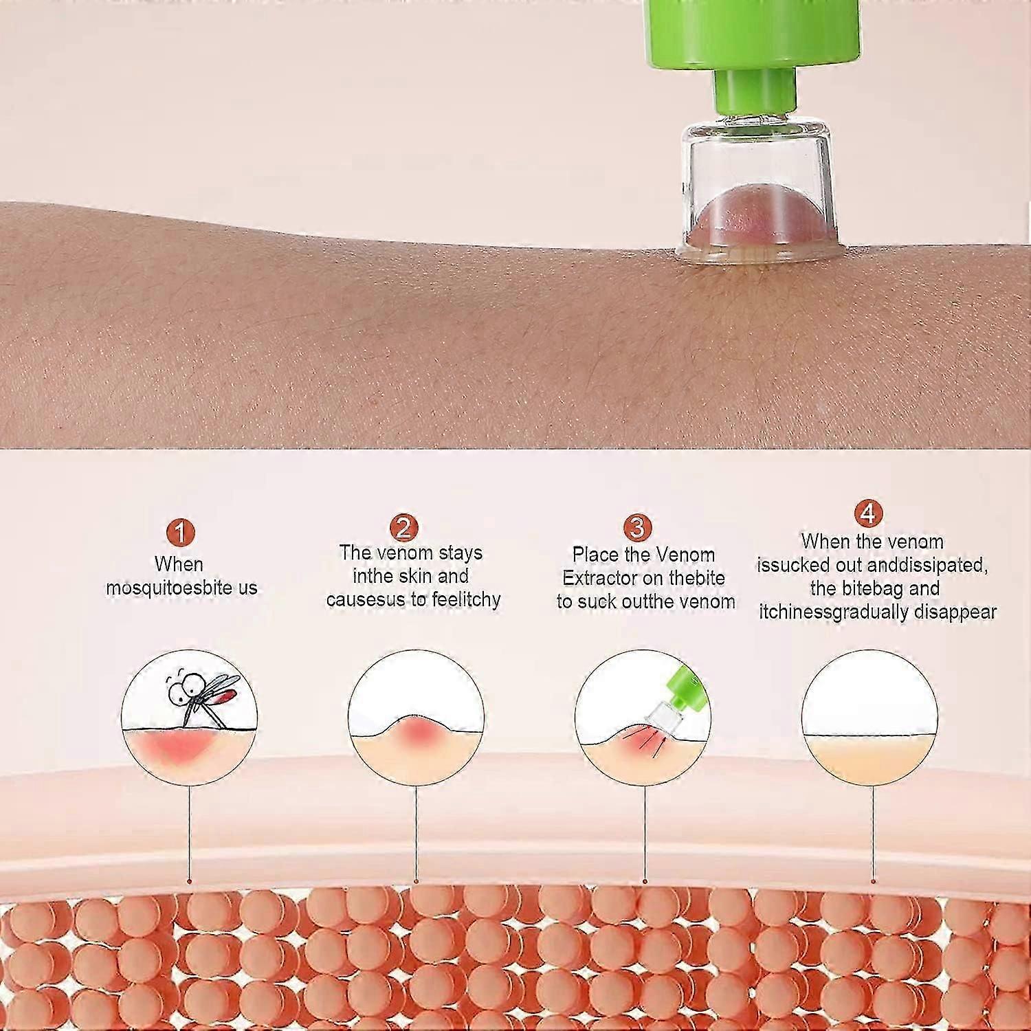 high qualityBites Relief Suction Tool, Venom Extractor Suction Pump ...