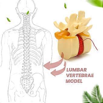 Model bederních obratlů Anatomická páteř Bederní ploténka Herniace ...