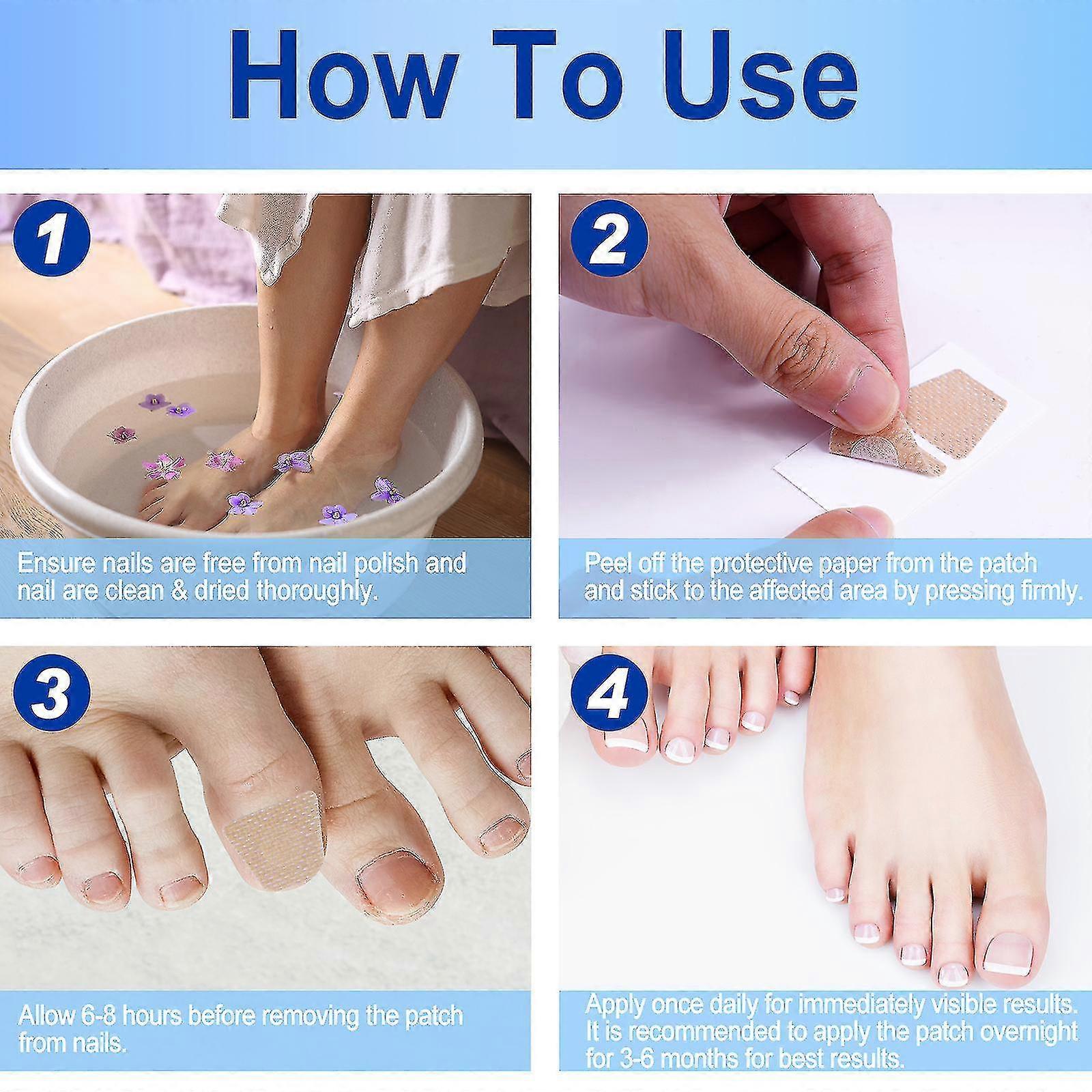 Nail Repair Patches, Nail Fungus Treatments, Split Nail Repair ...
