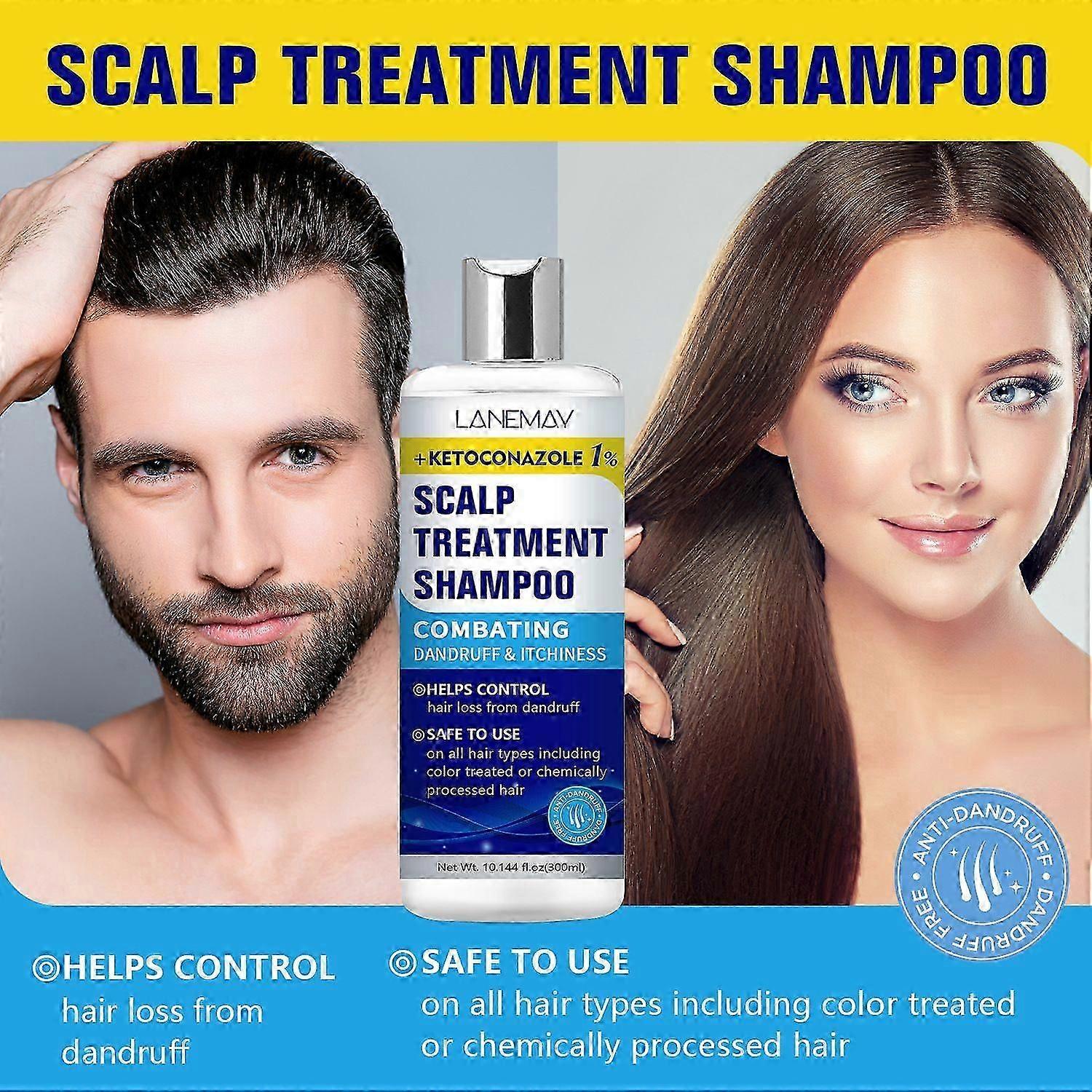 Scalp Treatment Shampoo, 1% Ketoconazole Formula Scalp Treatment ...