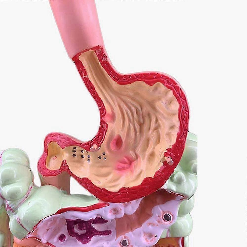 Human Digestive System Model Stomach Anatomy Large Intestine Cecum ...
