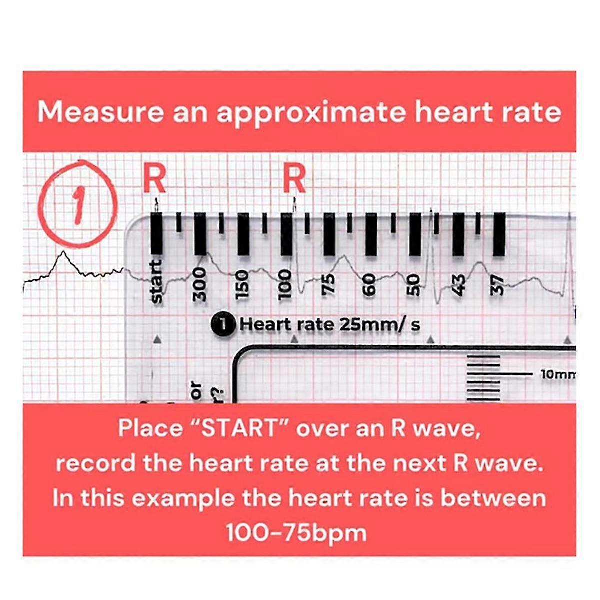 2PCS ECG 7 Step Ruler, ECG 7 Step Ruler for ECG/EKG Interpretation, ECG ...