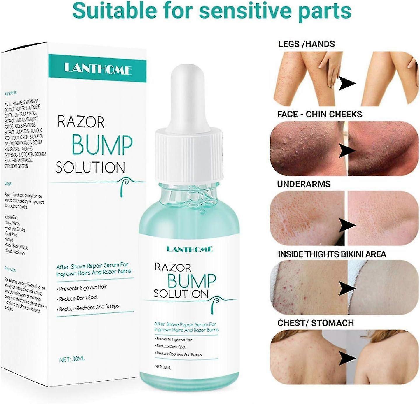 Razor Bumps Treatment For Women And Men, Anti-bumps Solution, After ...