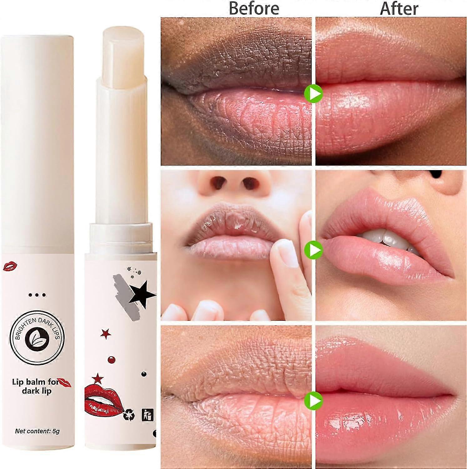 Lip Lightening For Dark Lips,moisturizing Lip Balm Whitening ...