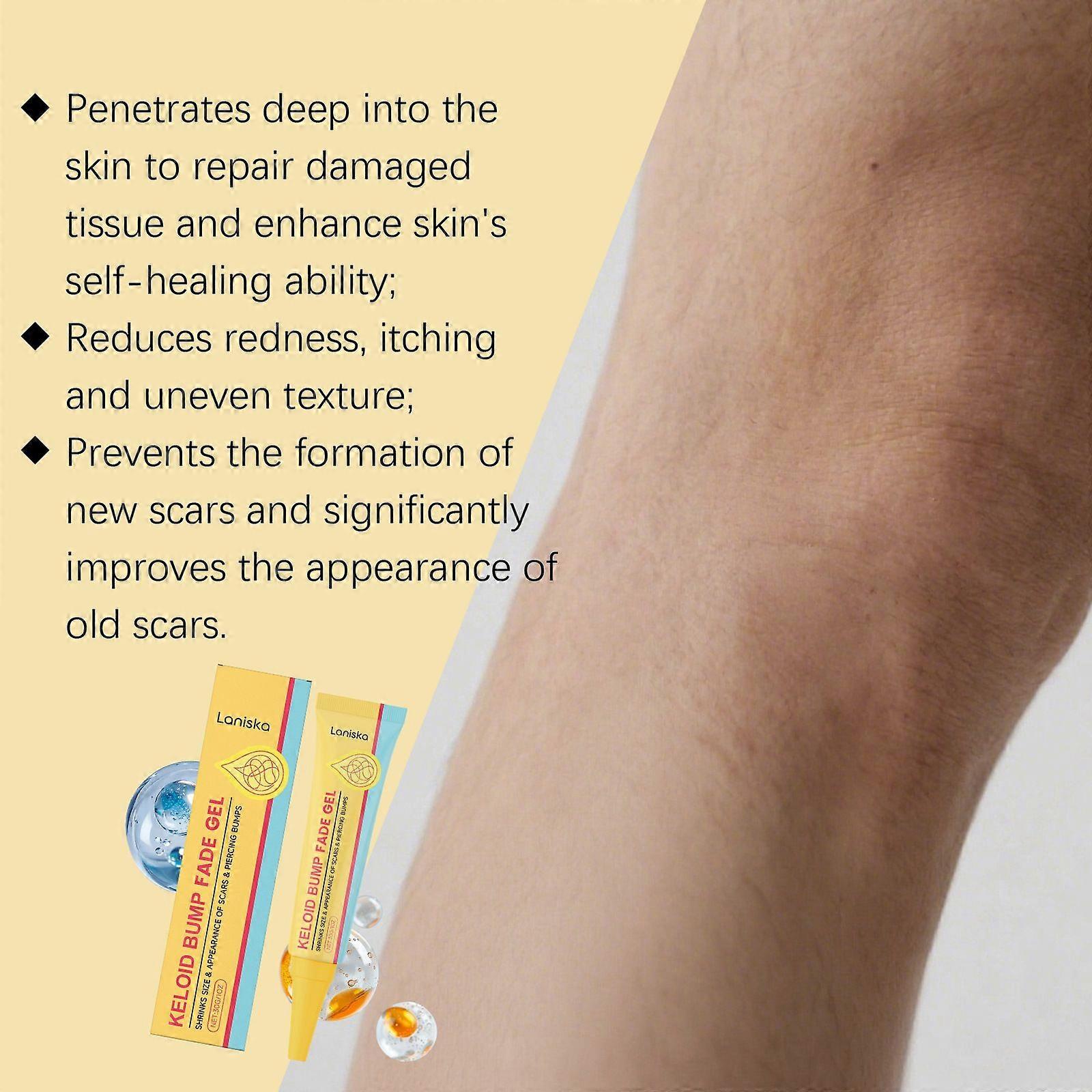 Keloid Bumps Removal Gel, Advanced Scar Gel for Face & Body, Scar Gel ...