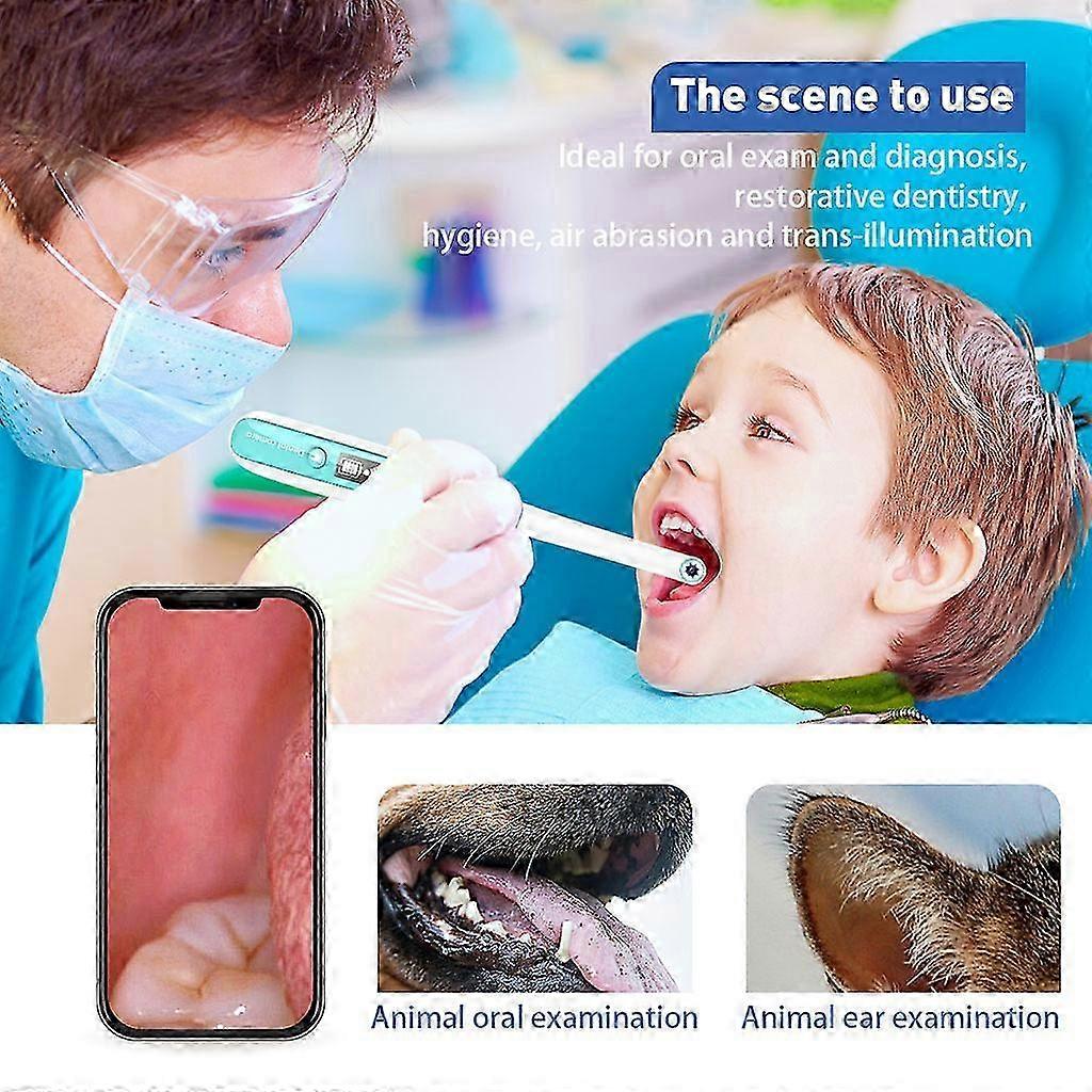 WiFi Intraoral Camera Endoscope Wireless Dental Camera Intraoral ...