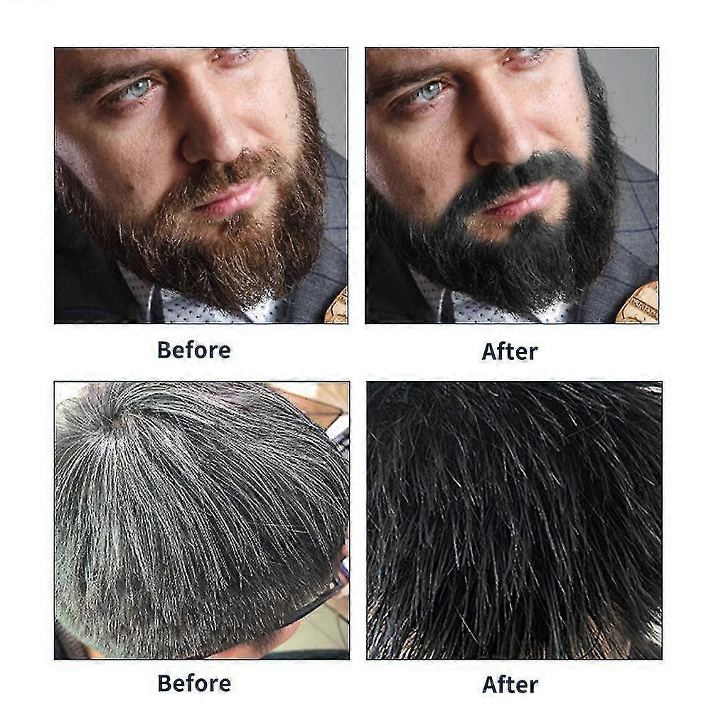 Beard Dye For Men, Black Beard And Hair Coloring Shampoo, Darkening ...