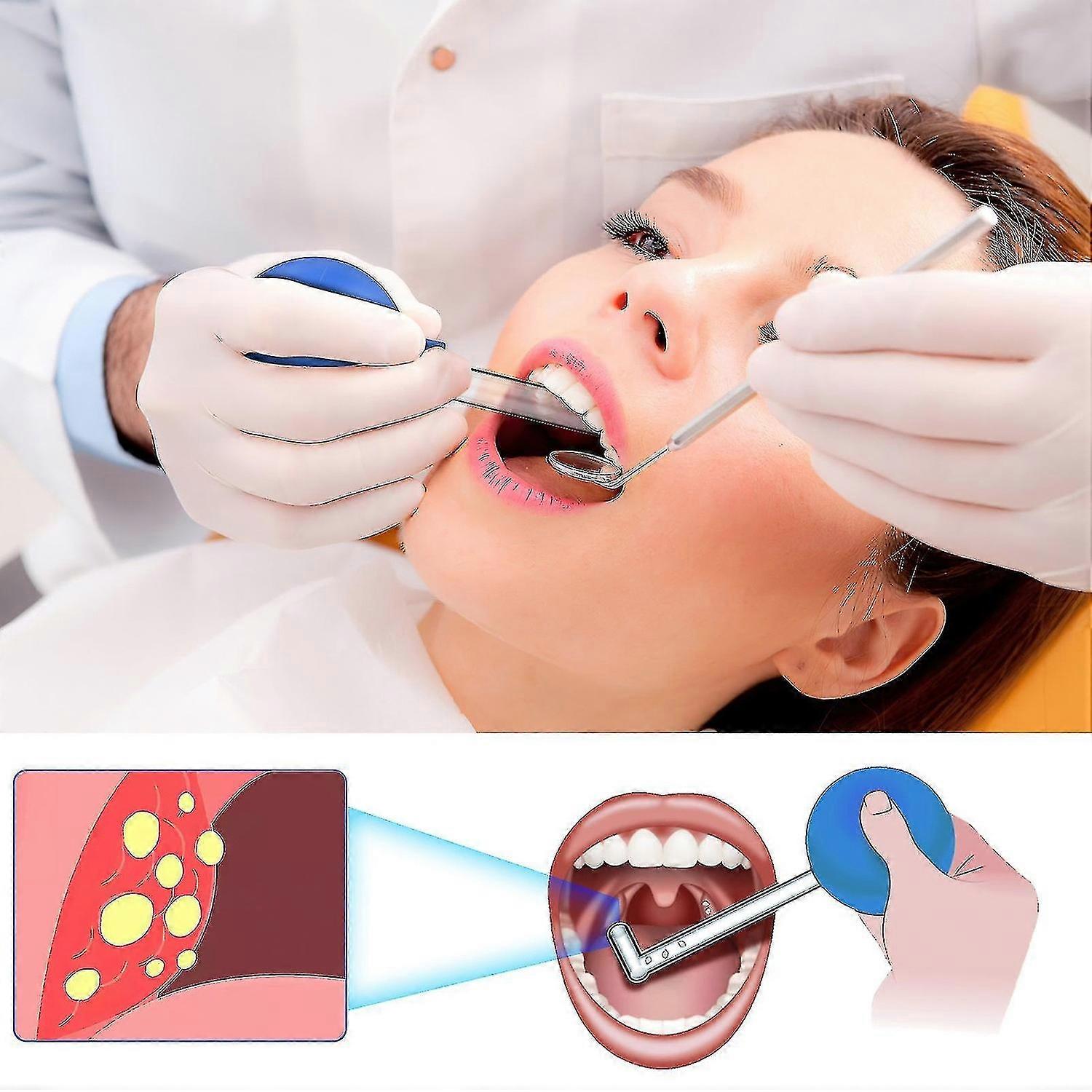 Portable Tonsils Stone Remover With Right Angle Tube Easy Carry ...