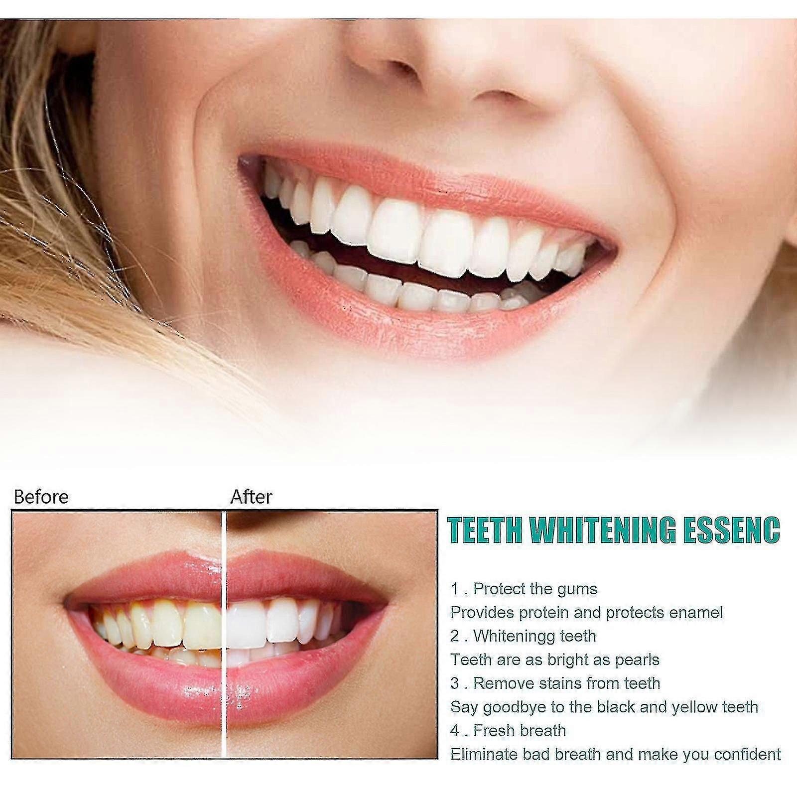 5-day Beauty Tooth Powder Whitening And Cleaning Teeth Smoke Stains To ...