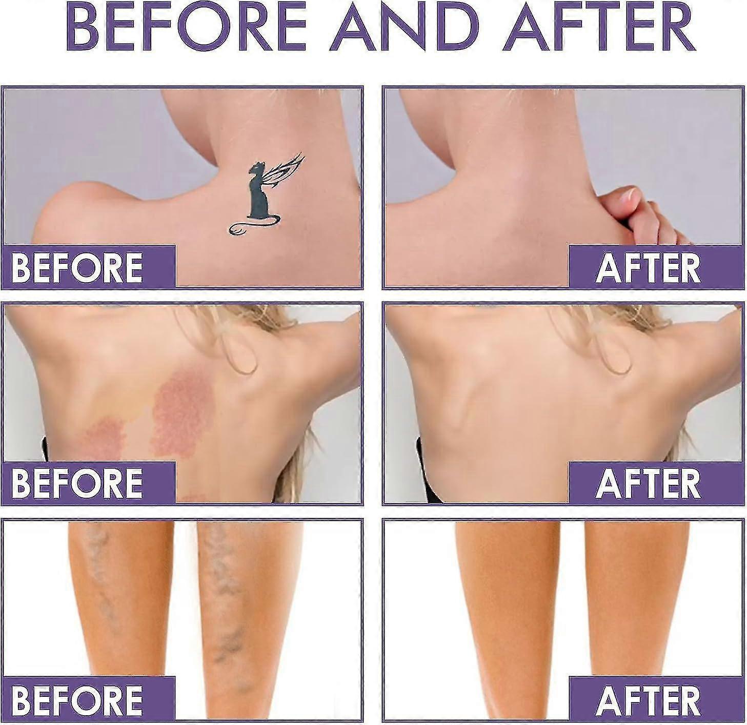 For Scars Body, Concealer, Cover Tattoo, Cosmetics, Waterproof ...