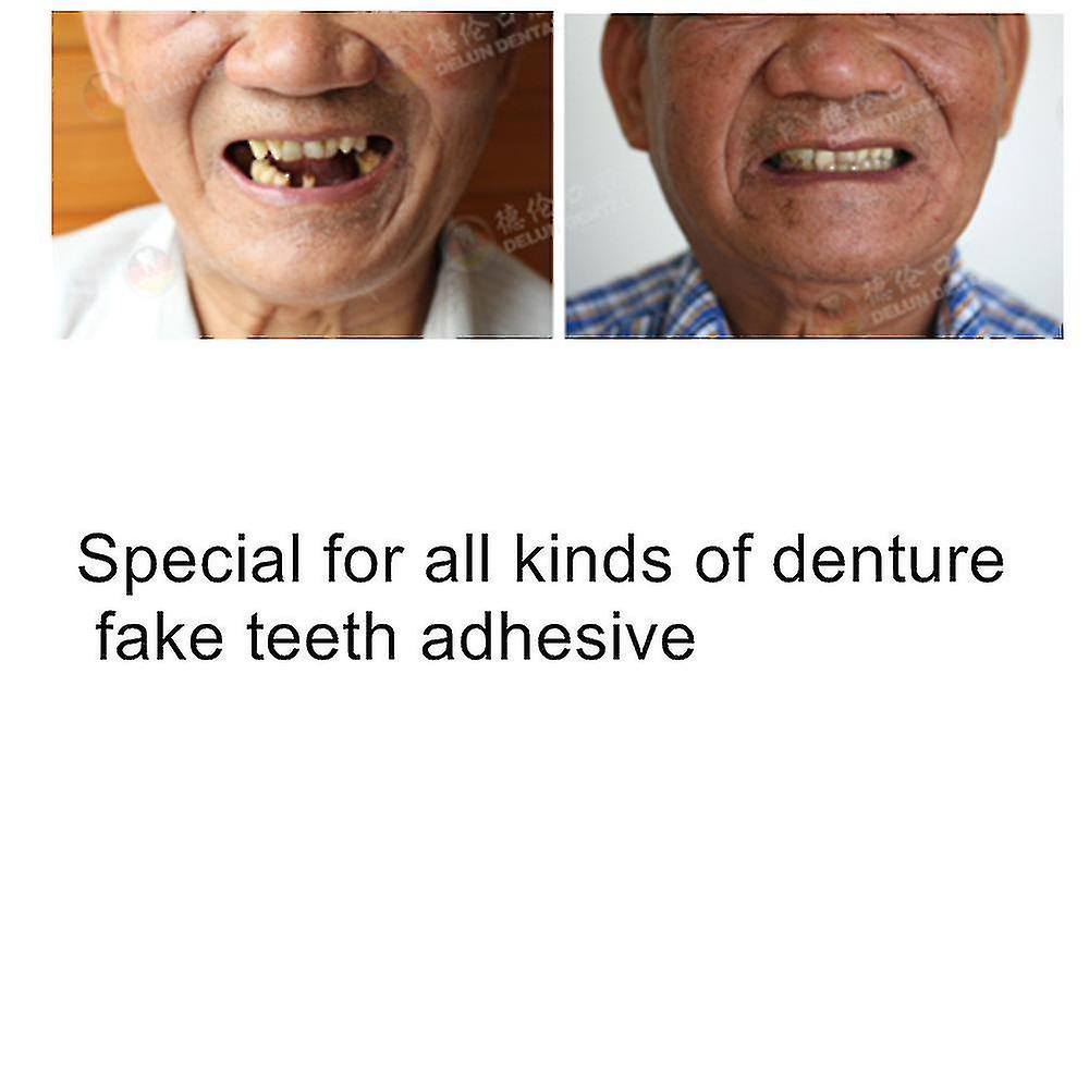 Dental Denture Oral False Fake Teeth Smile Veneers Paste Braces ...
