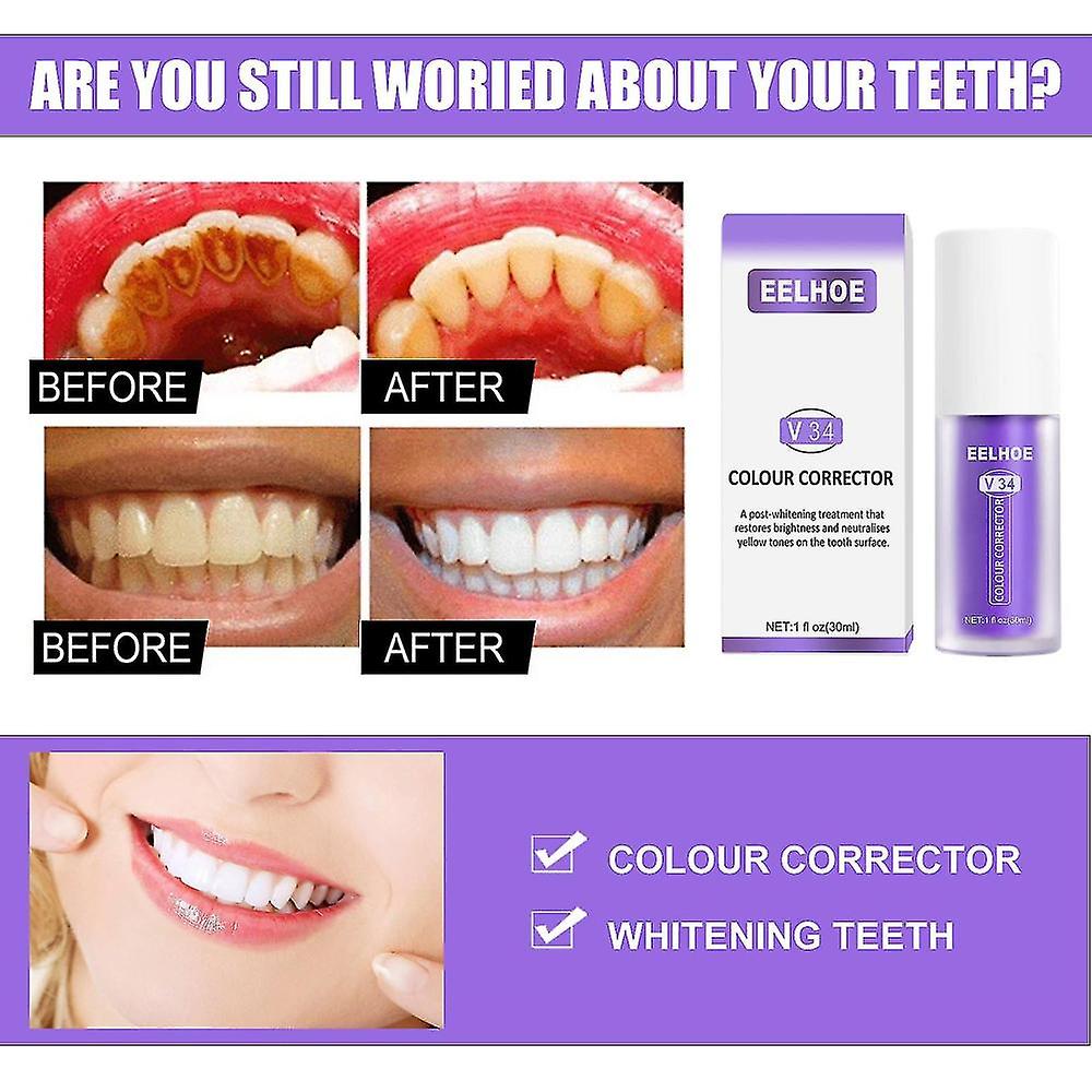 V34 Colour Corrector, Purple Teeth Whitening, Tooth Stain Removal ...