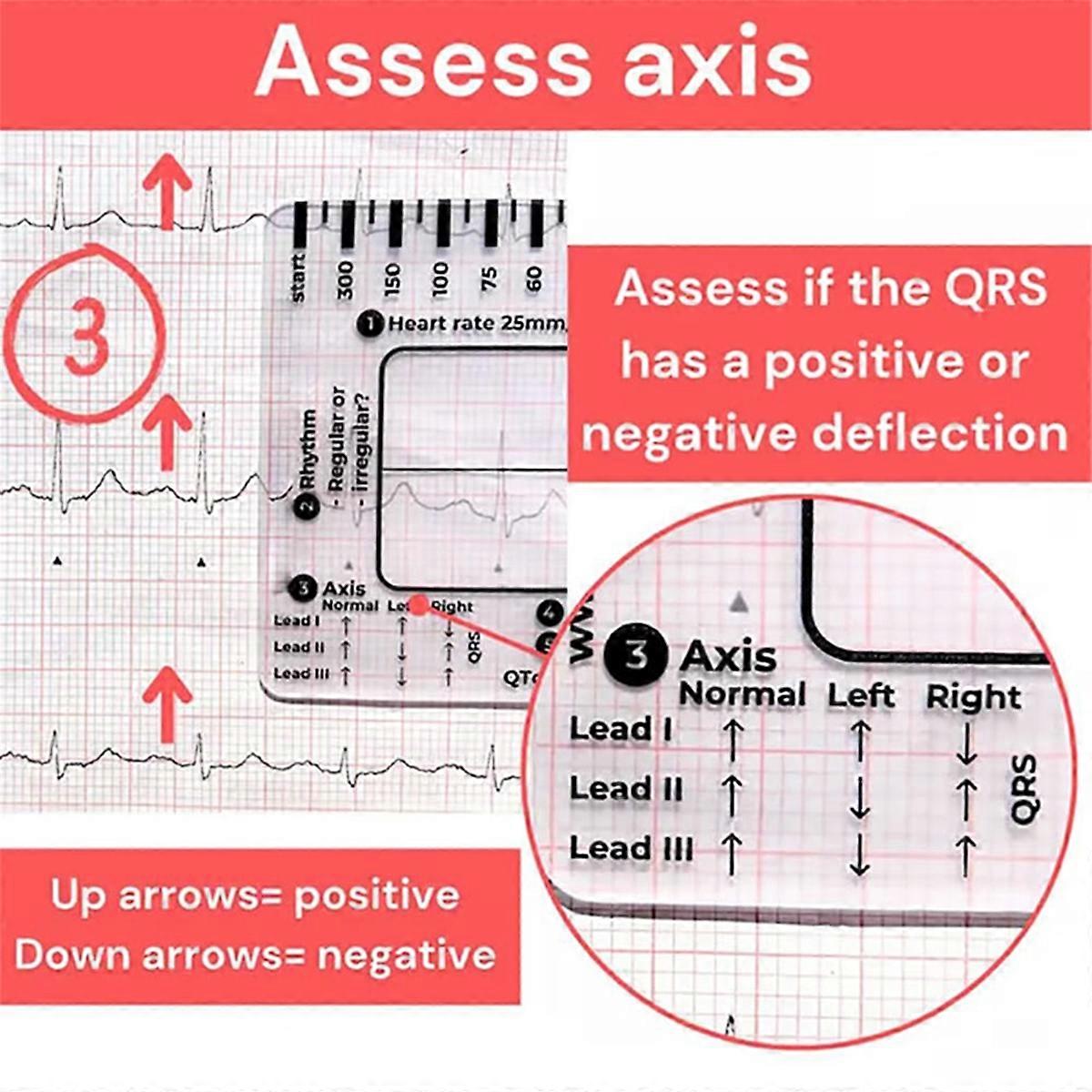 2PCS ECG 7 Step Ruler, ECG 7 Step Ruler for ECG/EKG Interpretation, ECG ...