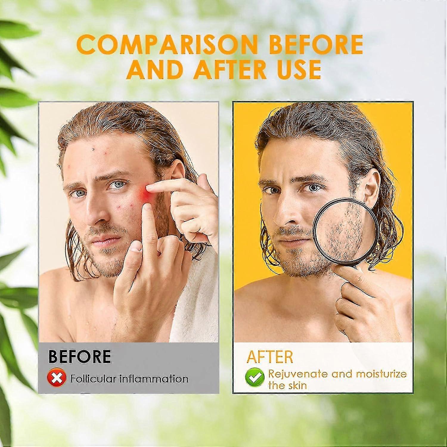 Hair Follicle Cream, Hair Follicle Repair Soothing Cream Deep ...