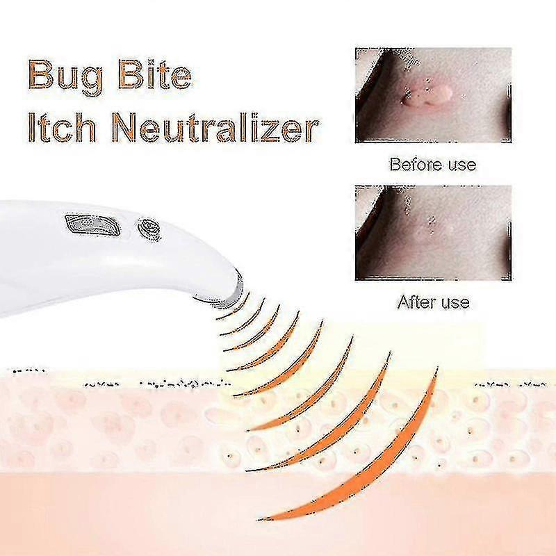 Antipruritic Apparatus Electric Mosquito Bite Antipruritic Device ...