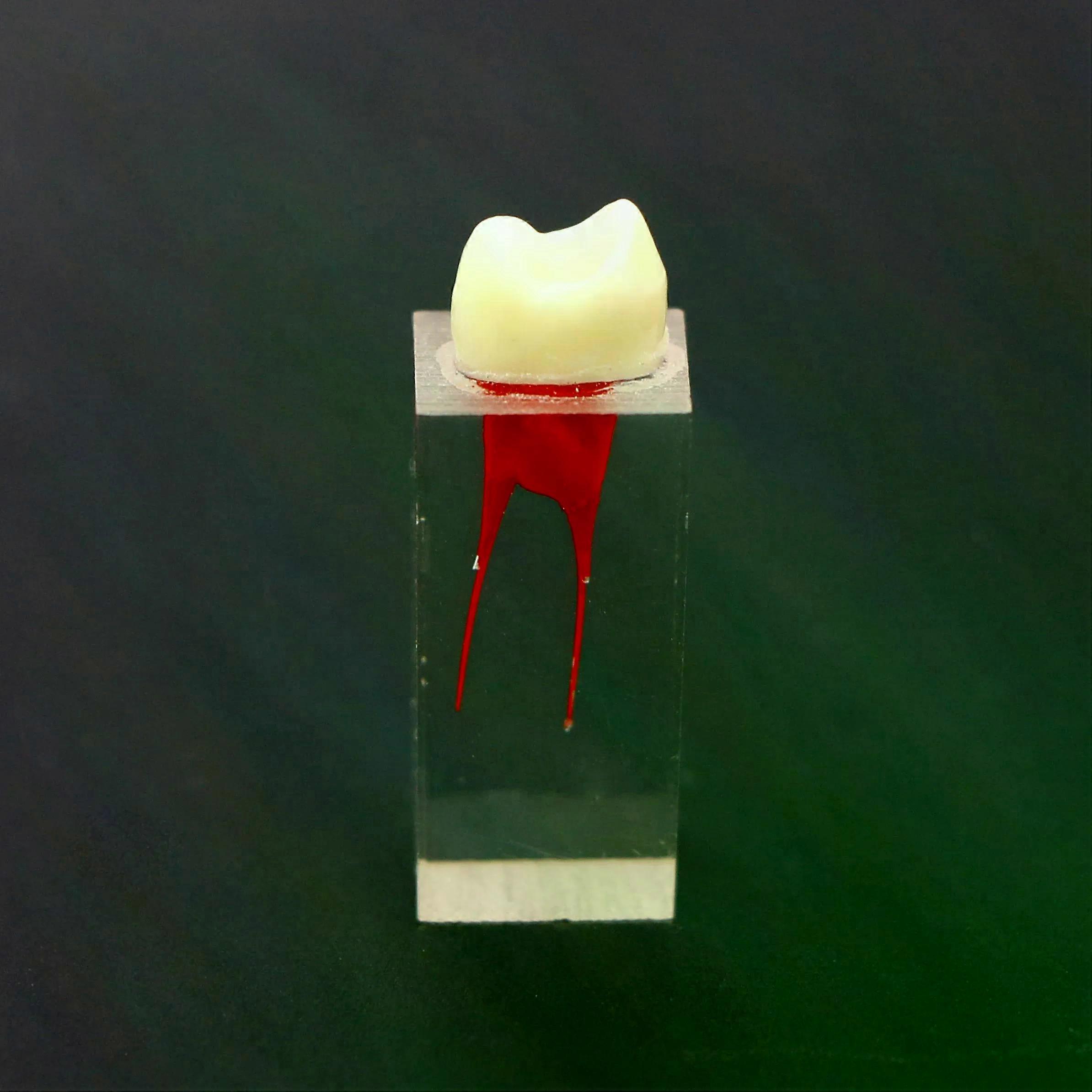 Gaibosi 5Pcs Dental Endodontic Root Model with Clear Resin Canal Block ...