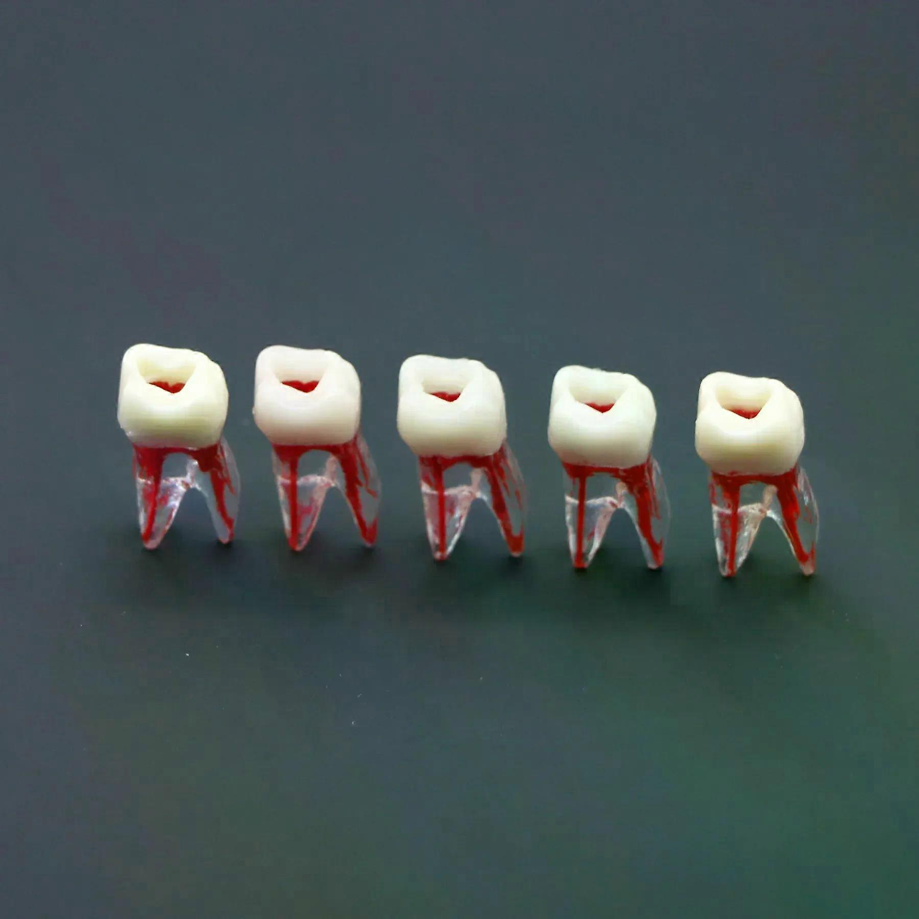 Gaibosi 5Pcs Dental Endodontic Root Model with Clear Resin Canal Block ...