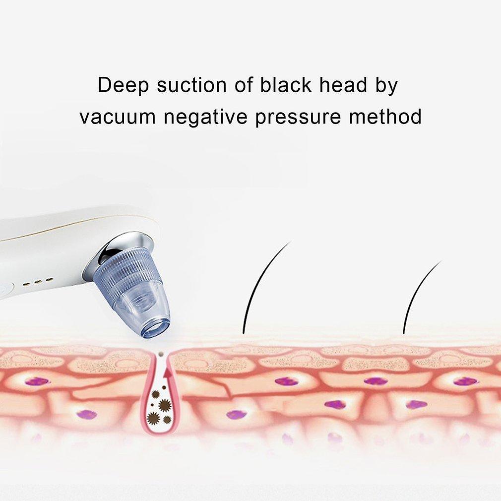 Blackhead Facial Pore Cleaner Electric Acne Removal Facial Instrument ...