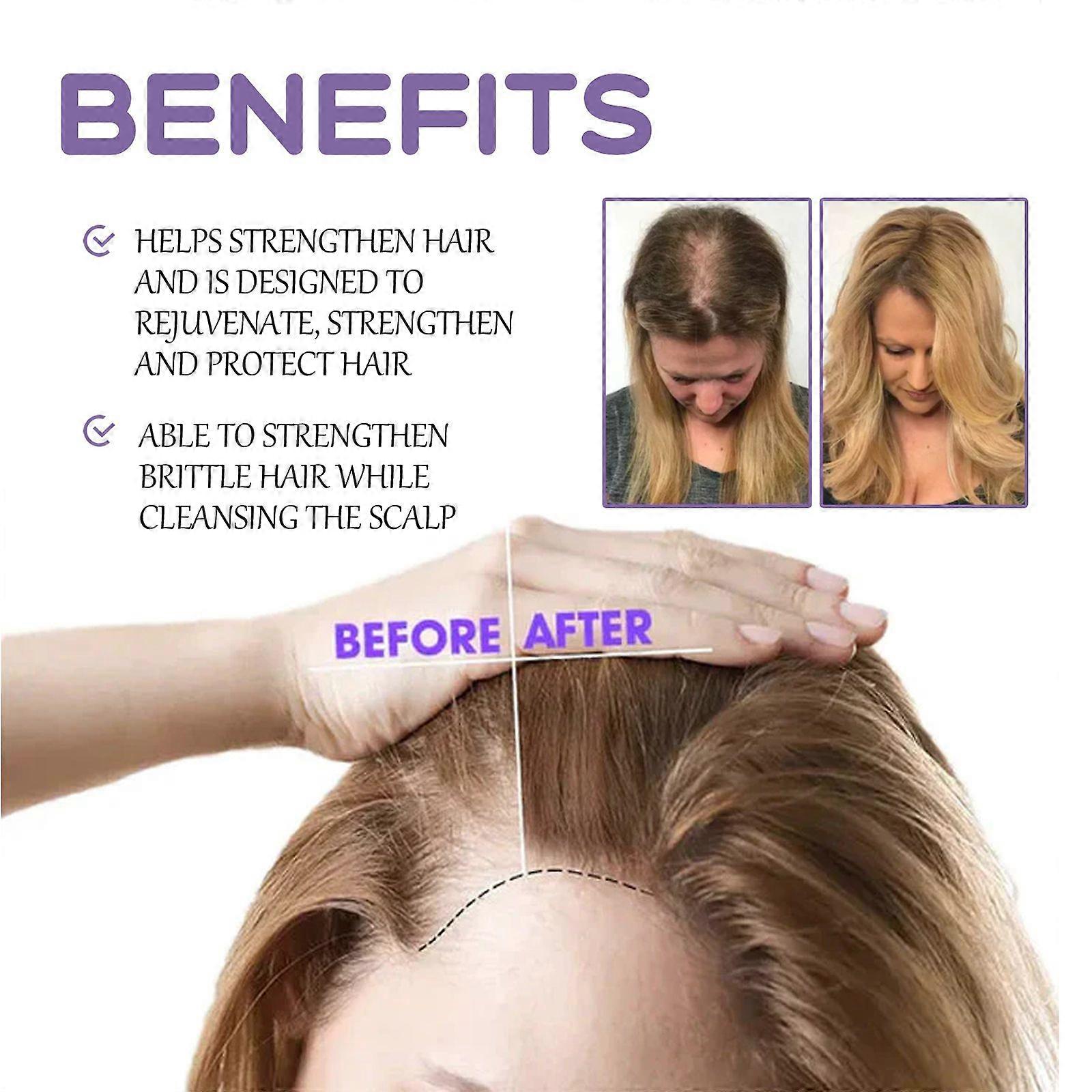 Hair Follicle Dense Hair Drops Repair Hair Follicle Nourishing Hair Roots Dense Solid Hair Care ...