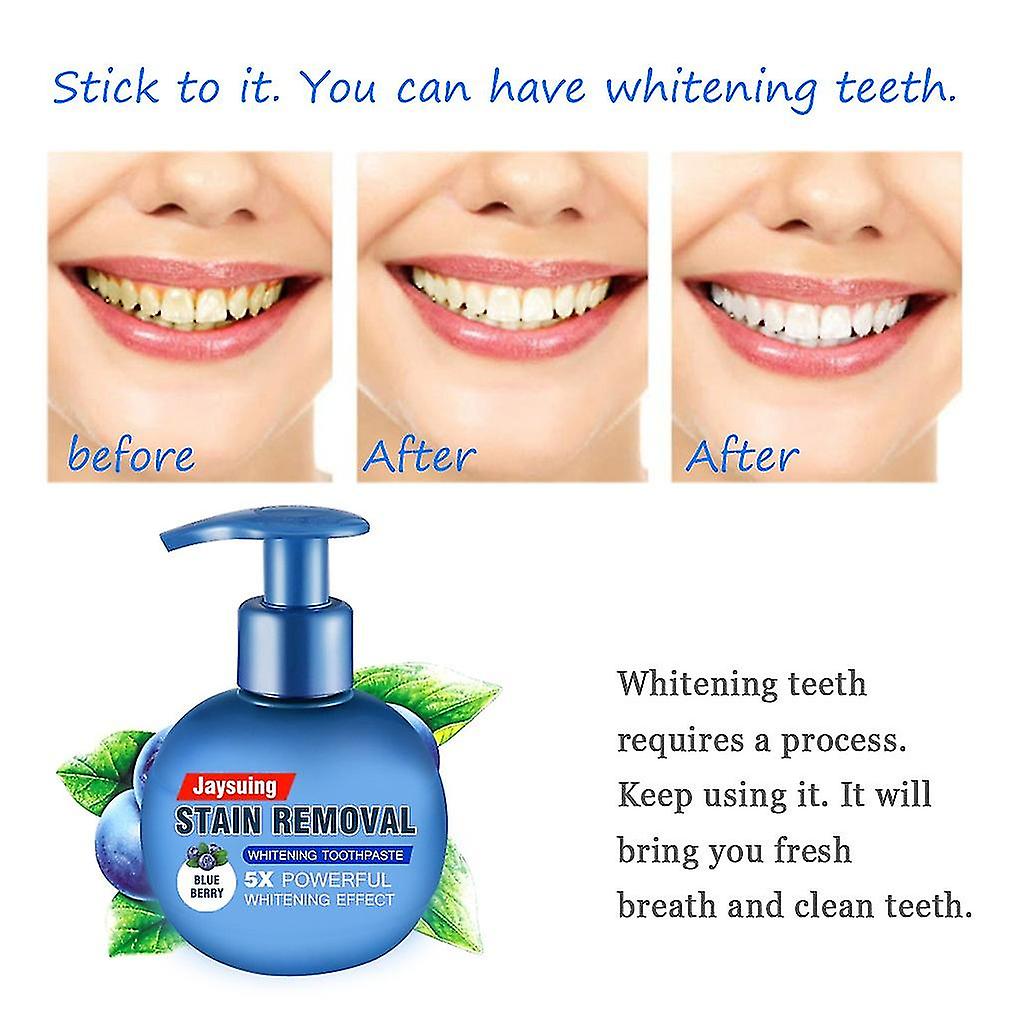 Stain Removal Whitening Toothpaste Fight Bleeding Gums Toothpaste 200ml ...