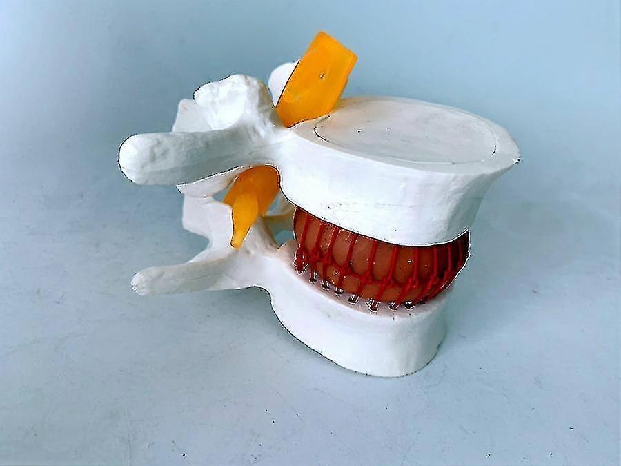 human Spine Model Vertebrae Lumbar Intervertebral Disc Model Vertebral ...