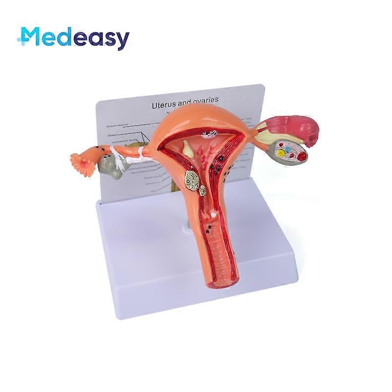 HaKeLai Female Uterus and Ovary Anatomical Model Vagina Model Plastic ...