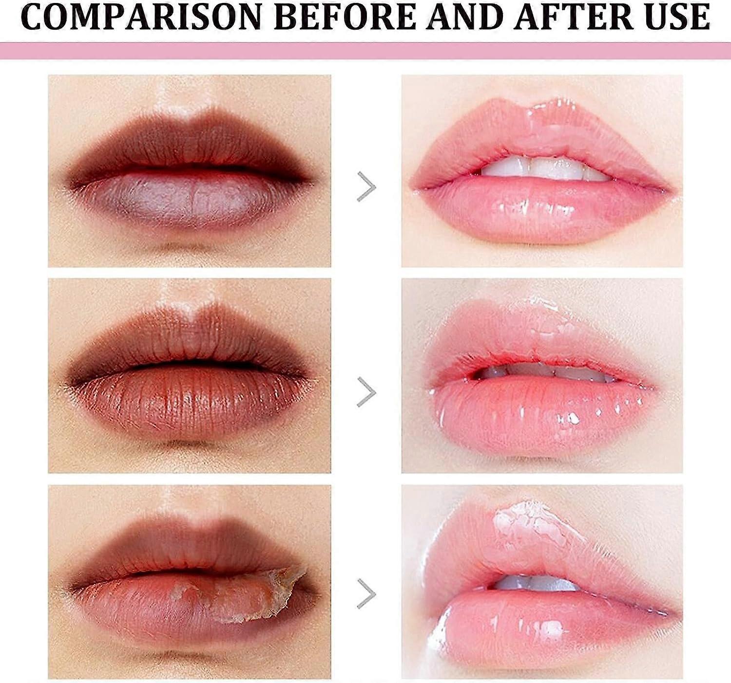 New Lips Pink Fresh Lightening Bleaching Cream Treatment Remove Dark ...