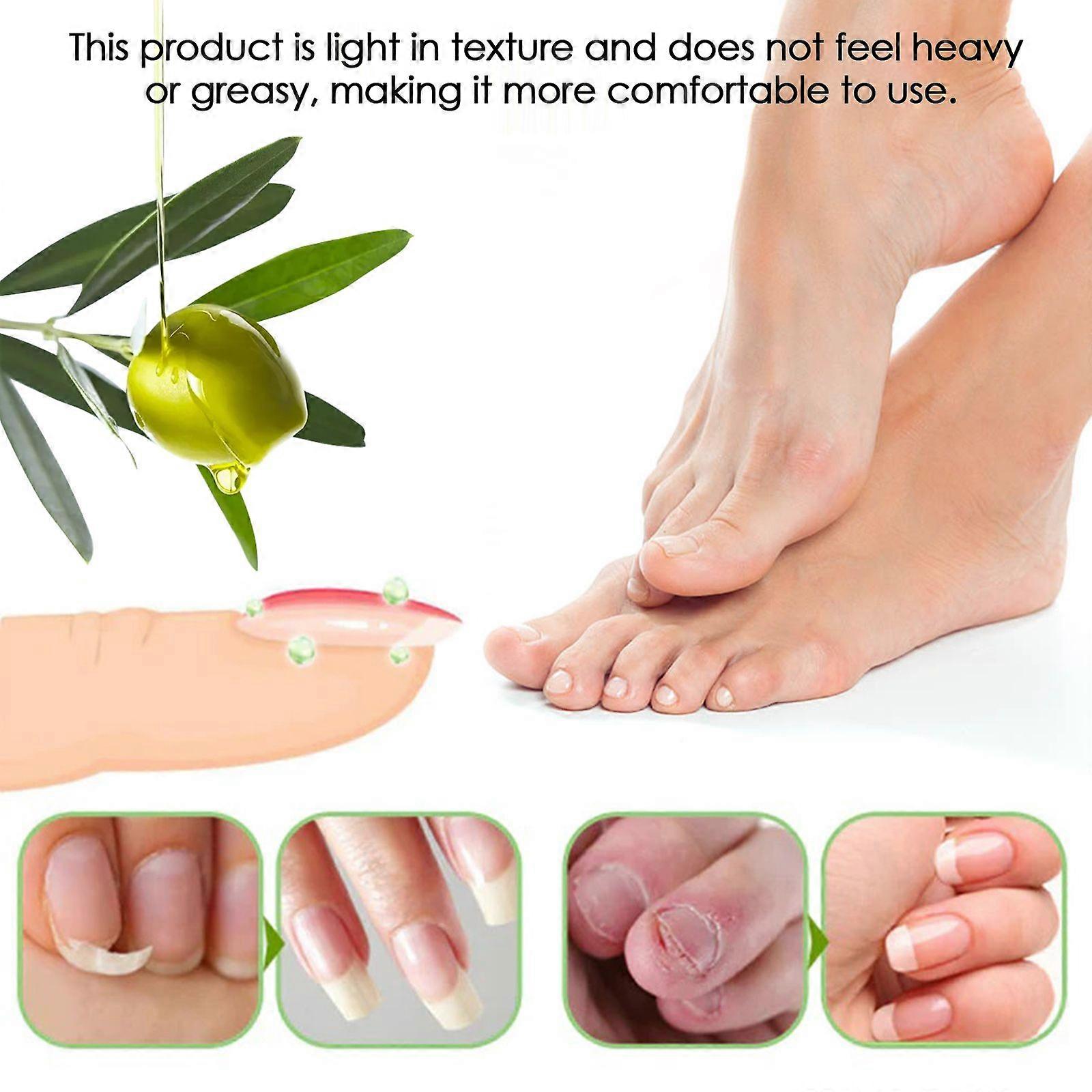 Cuticle Oil Pen, Repair Nails Rotten Nails Thickening Soft Nail Polish ...