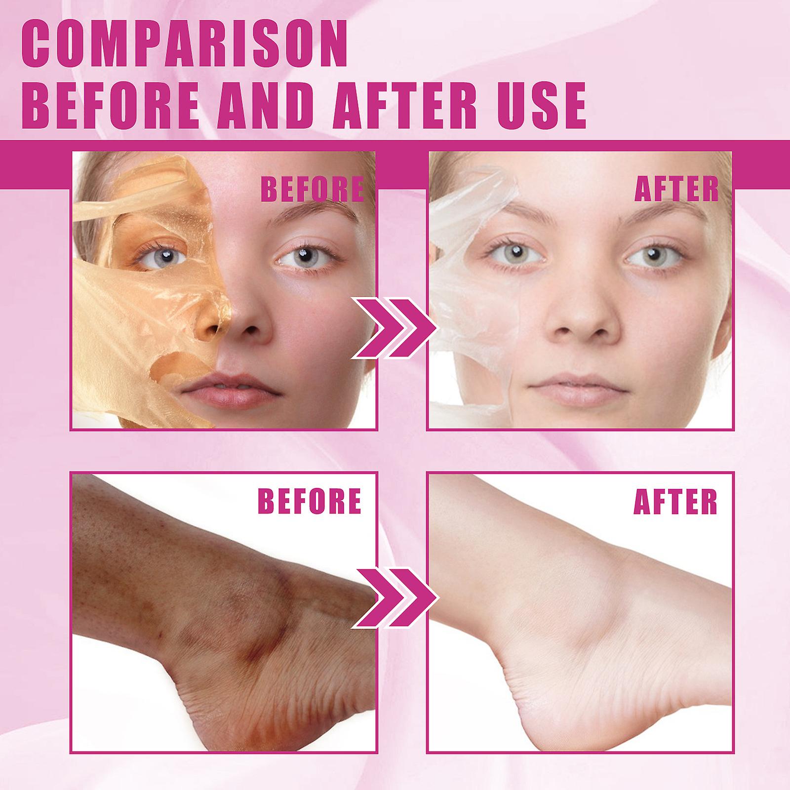 Peeling Oil For Dark Skin, Yellow Peeling Oil With Salicylic Sodium ...