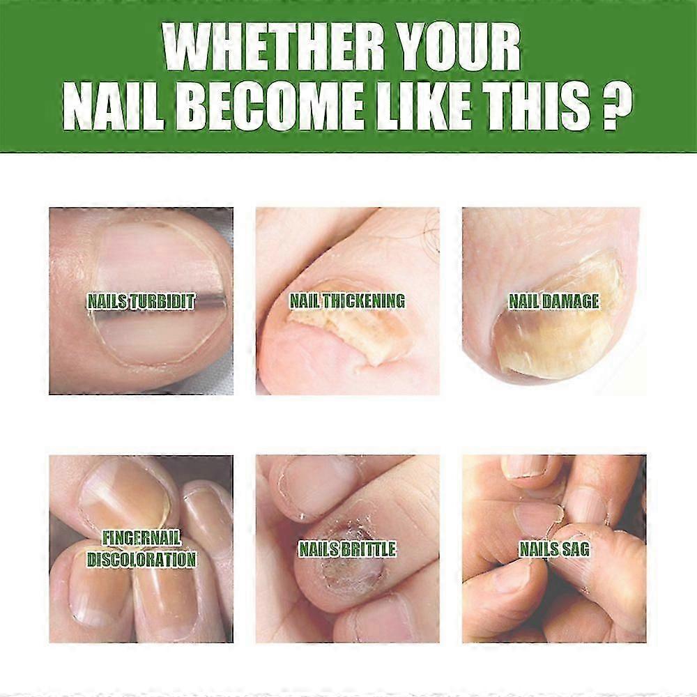 South Moon Nail Care Roller Balls - Nourishing Massage For Stronger ...