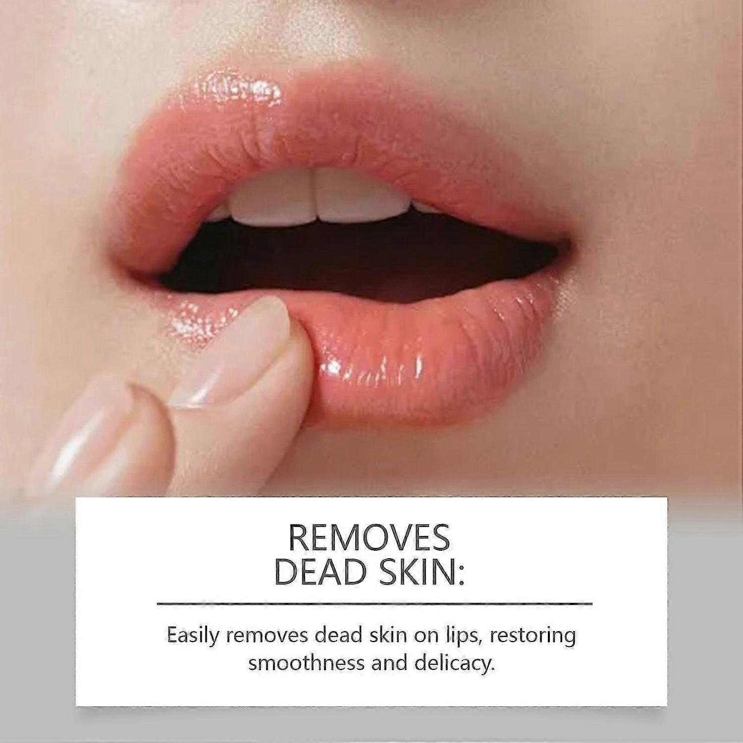 Lip Acne Cream, Fordyce Seeds - Lip Acne, Moisturizes, Improves Dry ...
