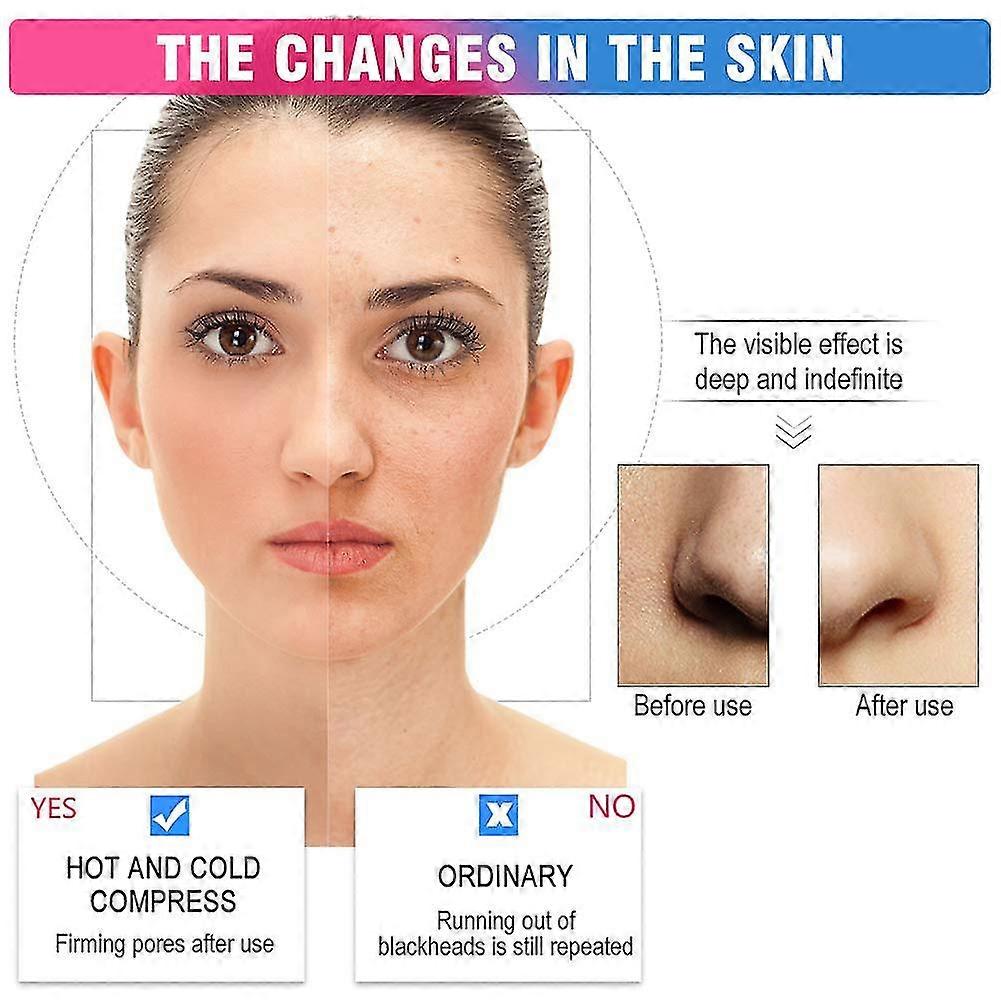 Electric Facial Pore Cleaner With 3 Hot And Cold Care Skin Repair Lamps ...