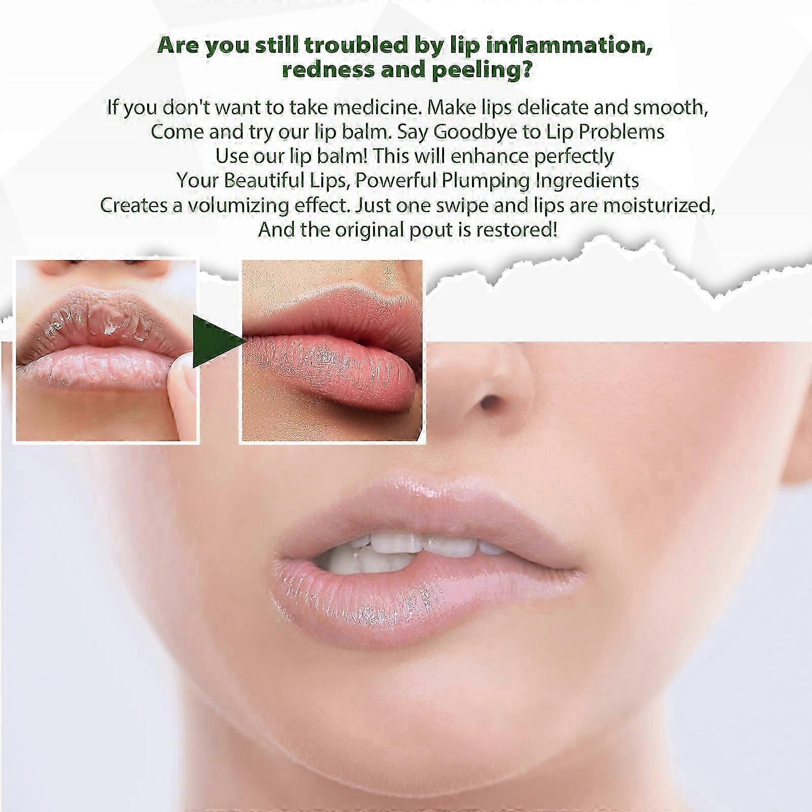 high quality 20g Lip Repair Cream, Hydrating Lip Balm, Natural ...