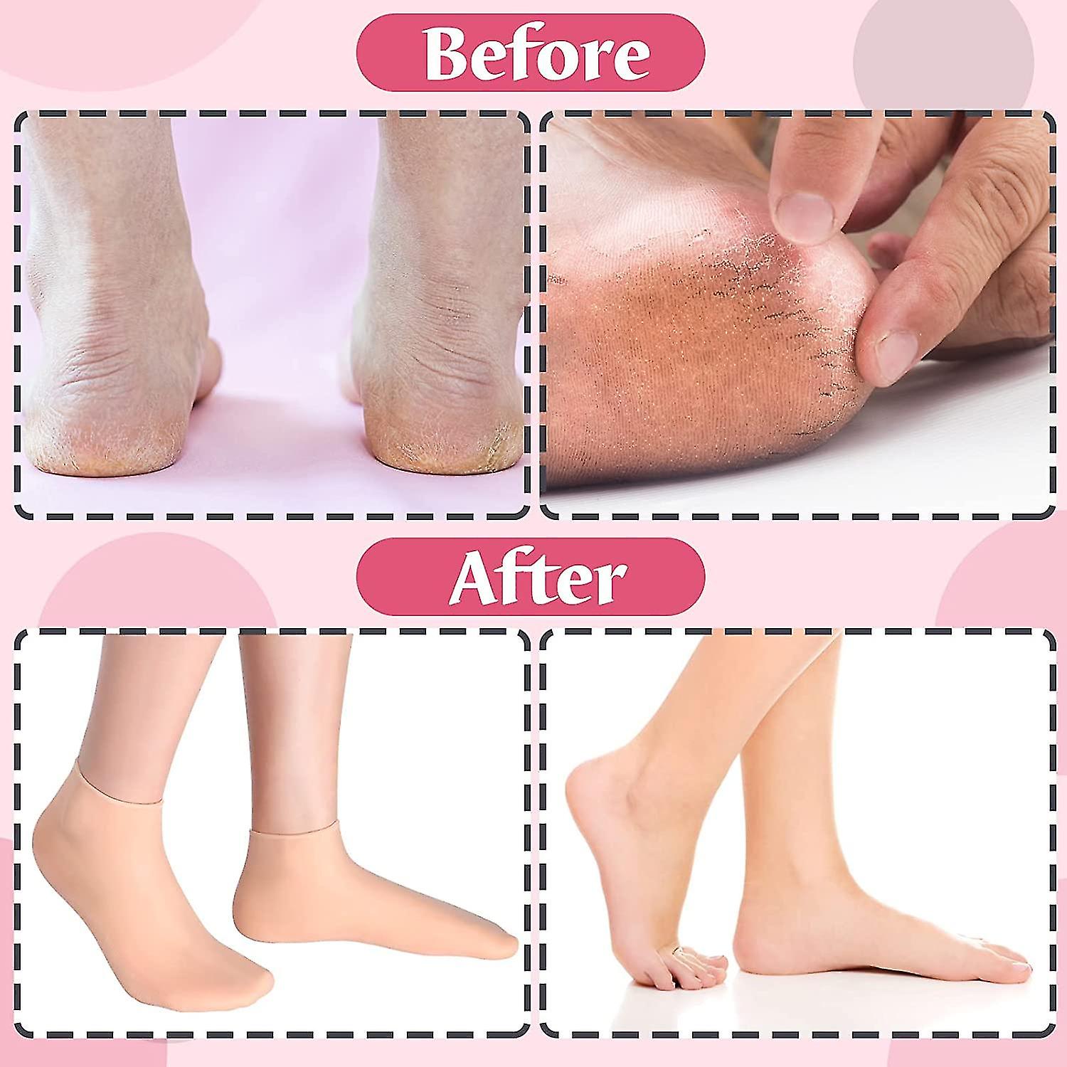 3pairs Silicone Socks, Silicone Moisturizing Sock, Silicone Heel Sock, Moisturizing Gel Socks ...