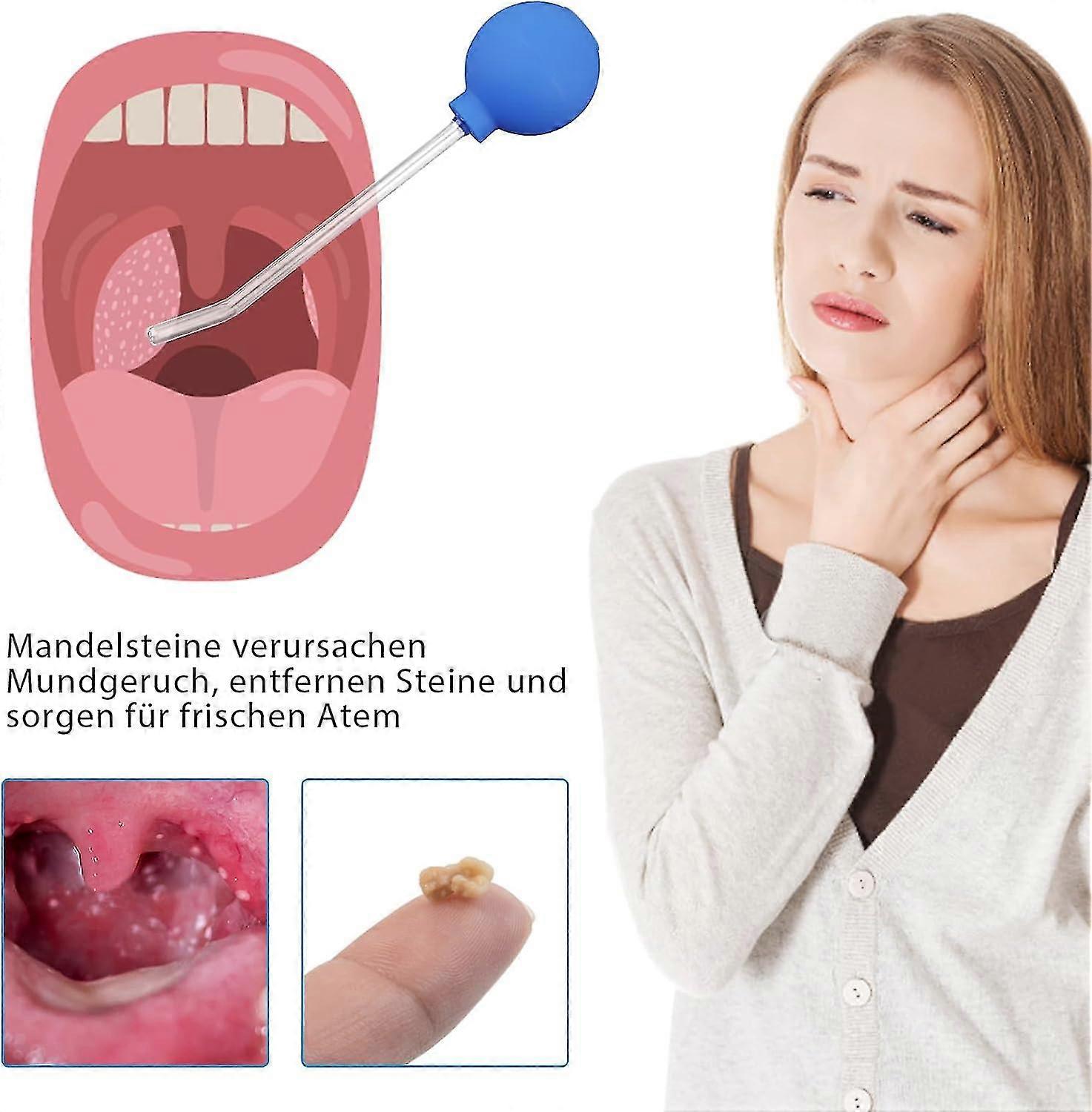 Tonsil Stone Remover, Tonsil Stone Removal Kit, Amandel Stenen Cupping ...