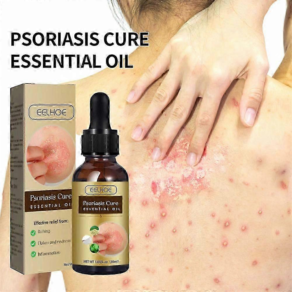 1-3PCS Psoriasis Relief Essential Oil Relieves Skin Itching Repairing ...