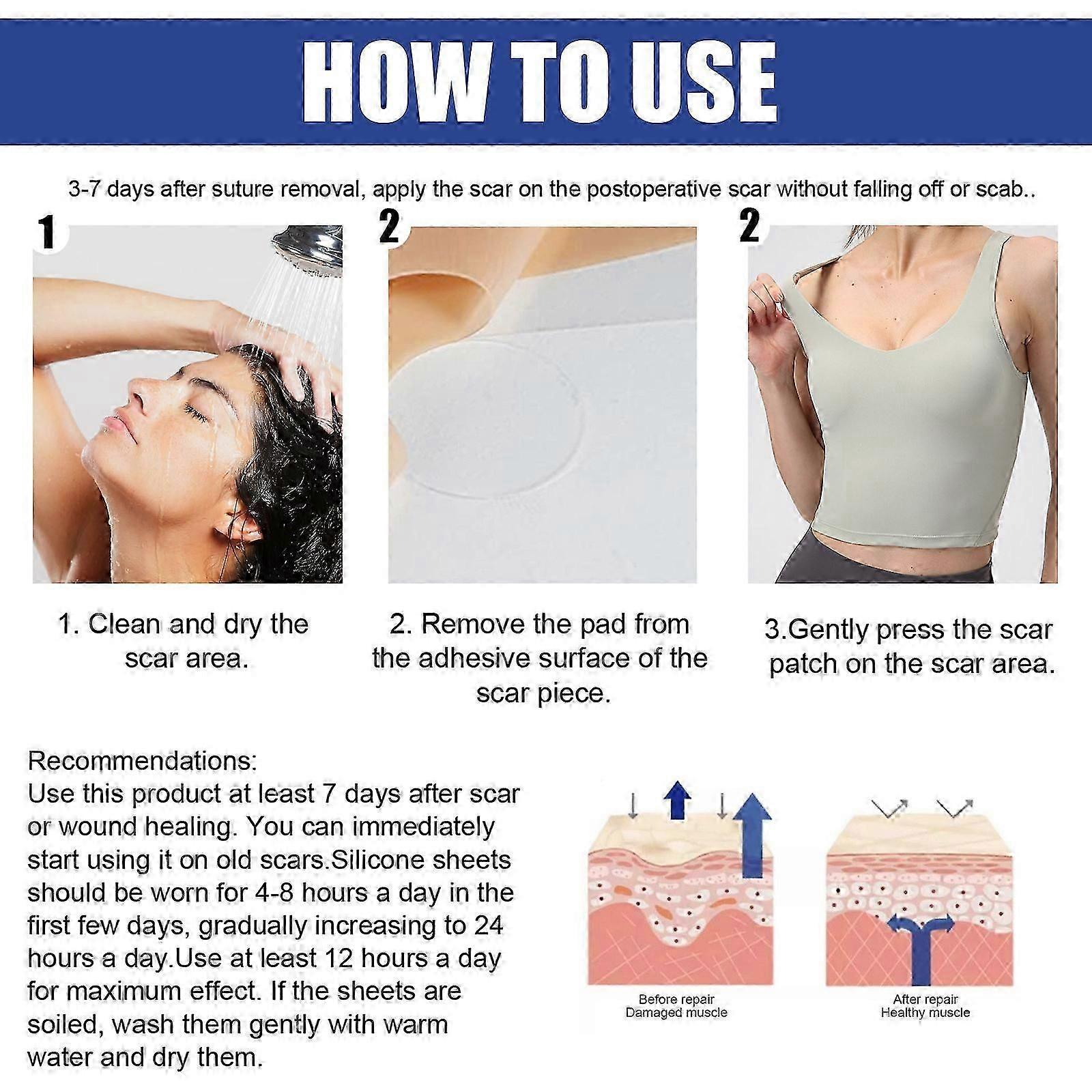 4 pairs Silicone Scar Sheets For Breast Reduction After Surgery For ...