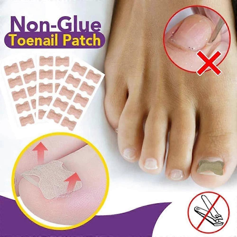 200pcs Toenail Correction Stickers, Ingrown Toenail Prevention Stickers ...