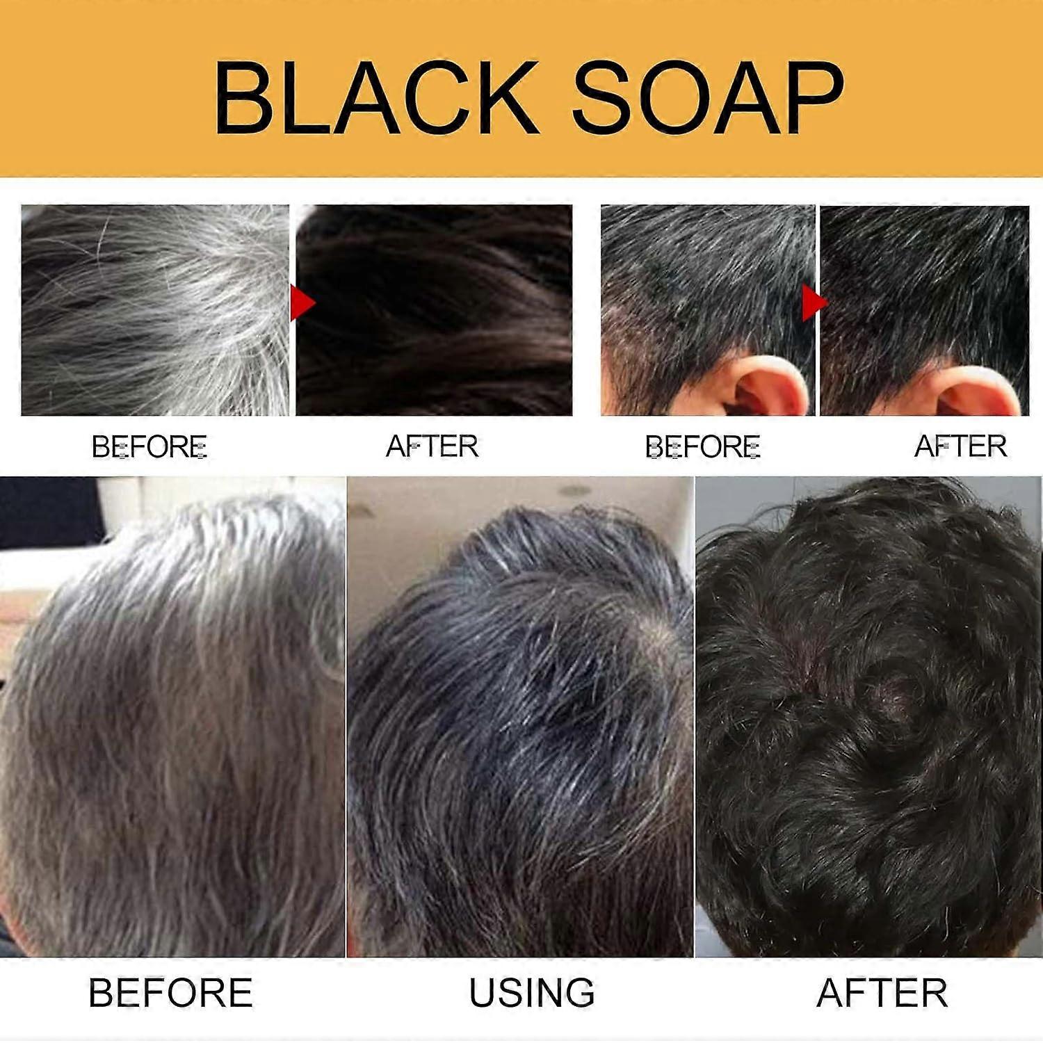 Anti Gray Bar, Gray Shine Soap, 2024 New Grey Hair Reverse Bar, Hair ...