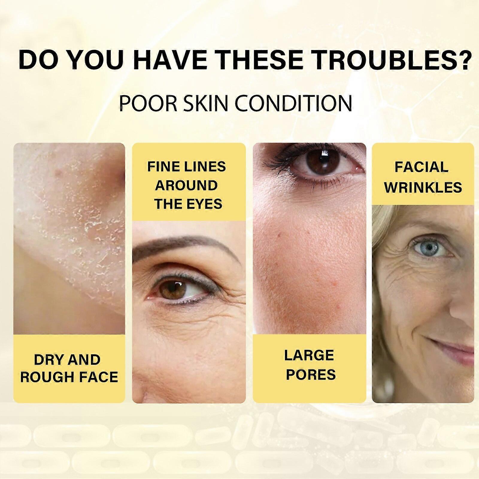 Protein Thread Lifting Set 24K Gold Face Serum Active Collagen Silk ...