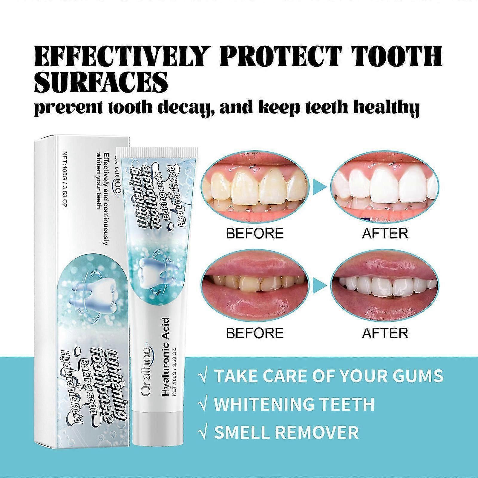 Hyaluronic Acid Dual-Effect Whitening Toothpaste, Hyaluronic Acid ...