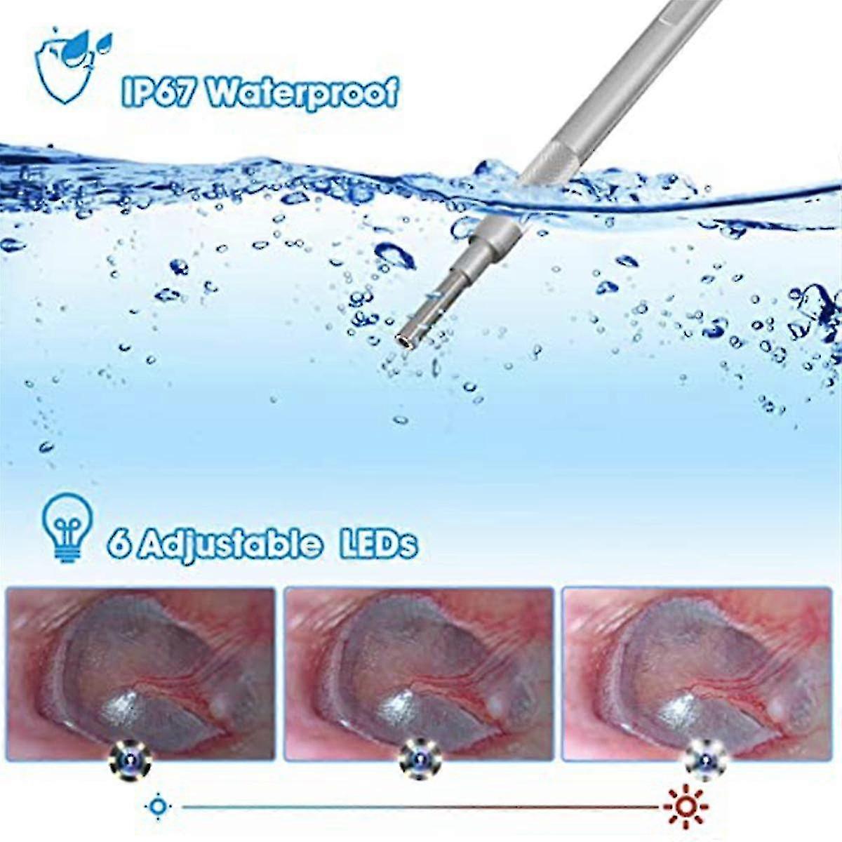 digital otoscope with 7-inch screen, ear camera, visual ear scoop ...