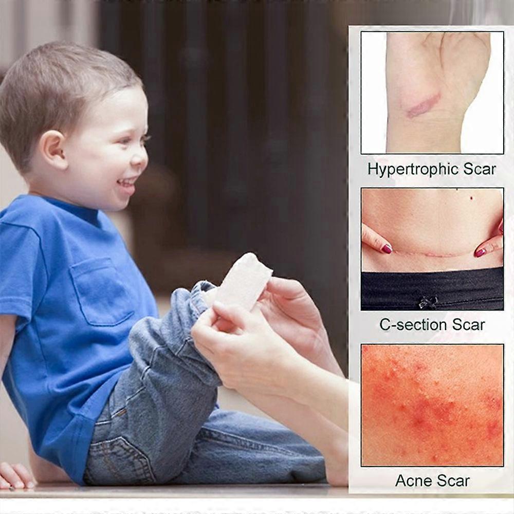 Scars Removal Stickers Self-adhesive Silicone Scar Tape Scar Lightening ...