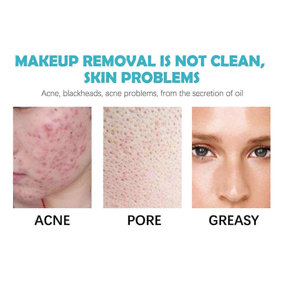 Low pH Niacinamide Micellar Cleansing Water Daily Mild Facial Cleansing ...