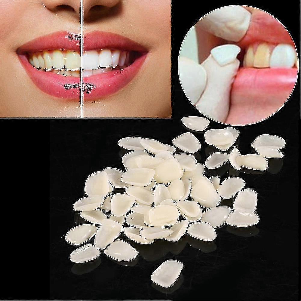 70pcs/bag Teeth Veneers Resin Anterior Upper Temporary Crown For Dental ...