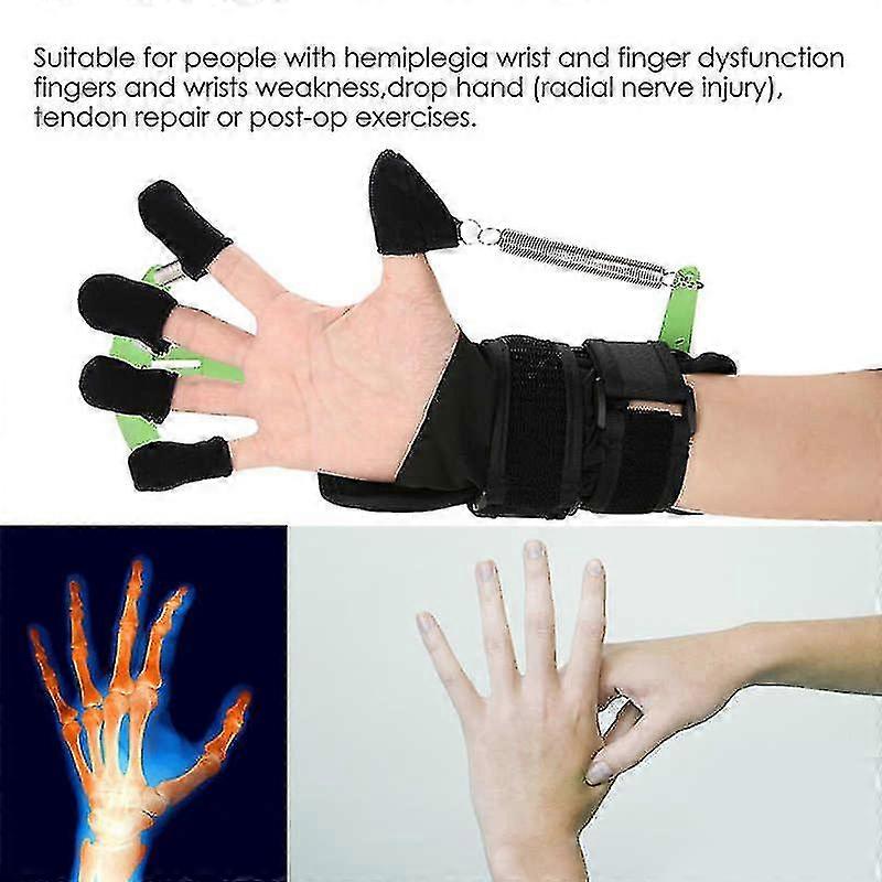 Orthopedic Brace Hands Finger Physiotherapy Training Wrist And Finger Dynamic Orthotic Device ...